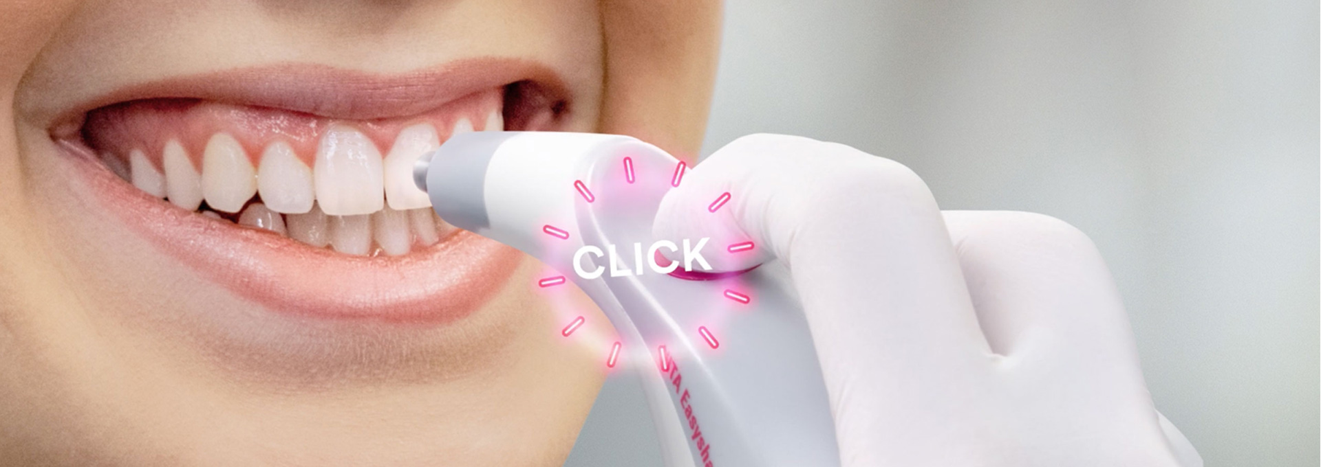 VITA Easyshade LITE – Digitale Zahnfarbbestimmung