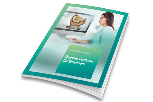 Digitale Prothesen herstellen – so gelingt der Einstieg!