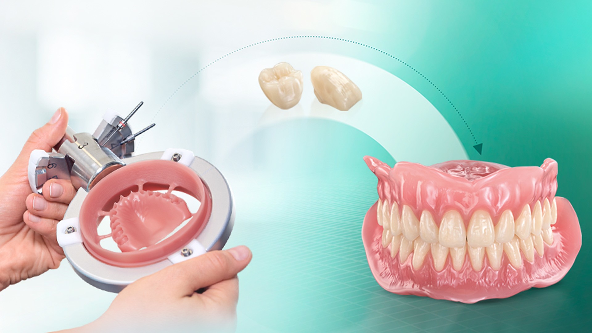 Fabriquer des prothèses amovibles numériques - voici comment se lancer ...
