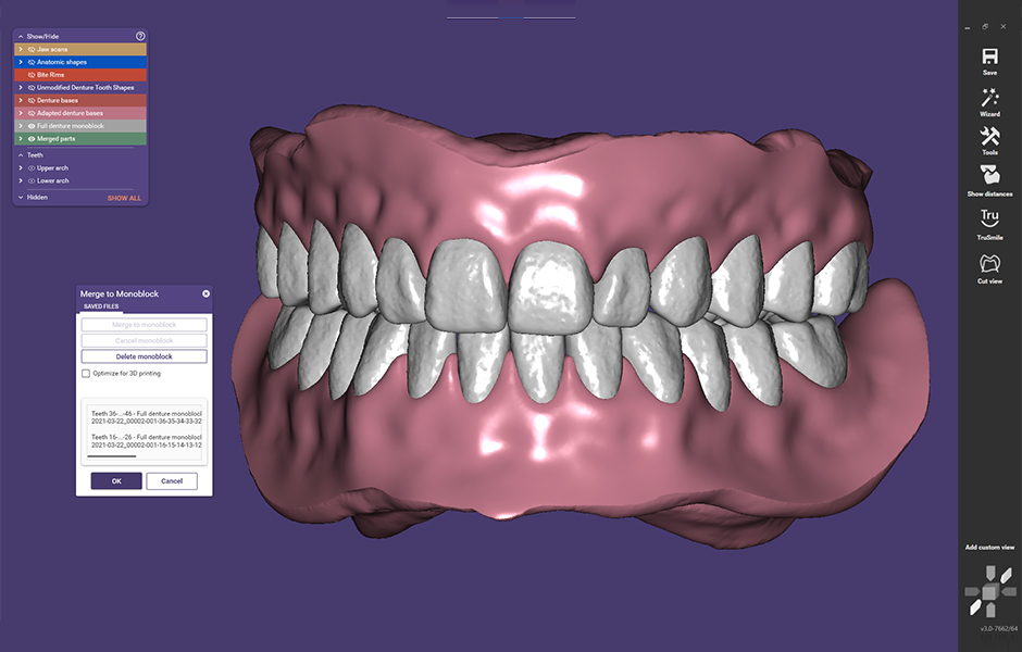 Fabricating digital dentures – here is how to get started!