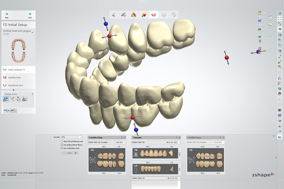 Fabricating digital dentures – here is how to get started!