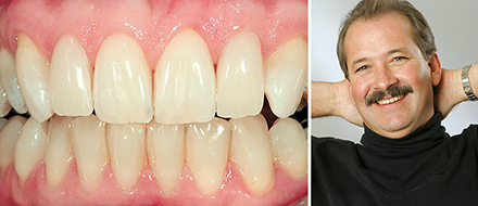 Patientenfälle VITA Masterpieces